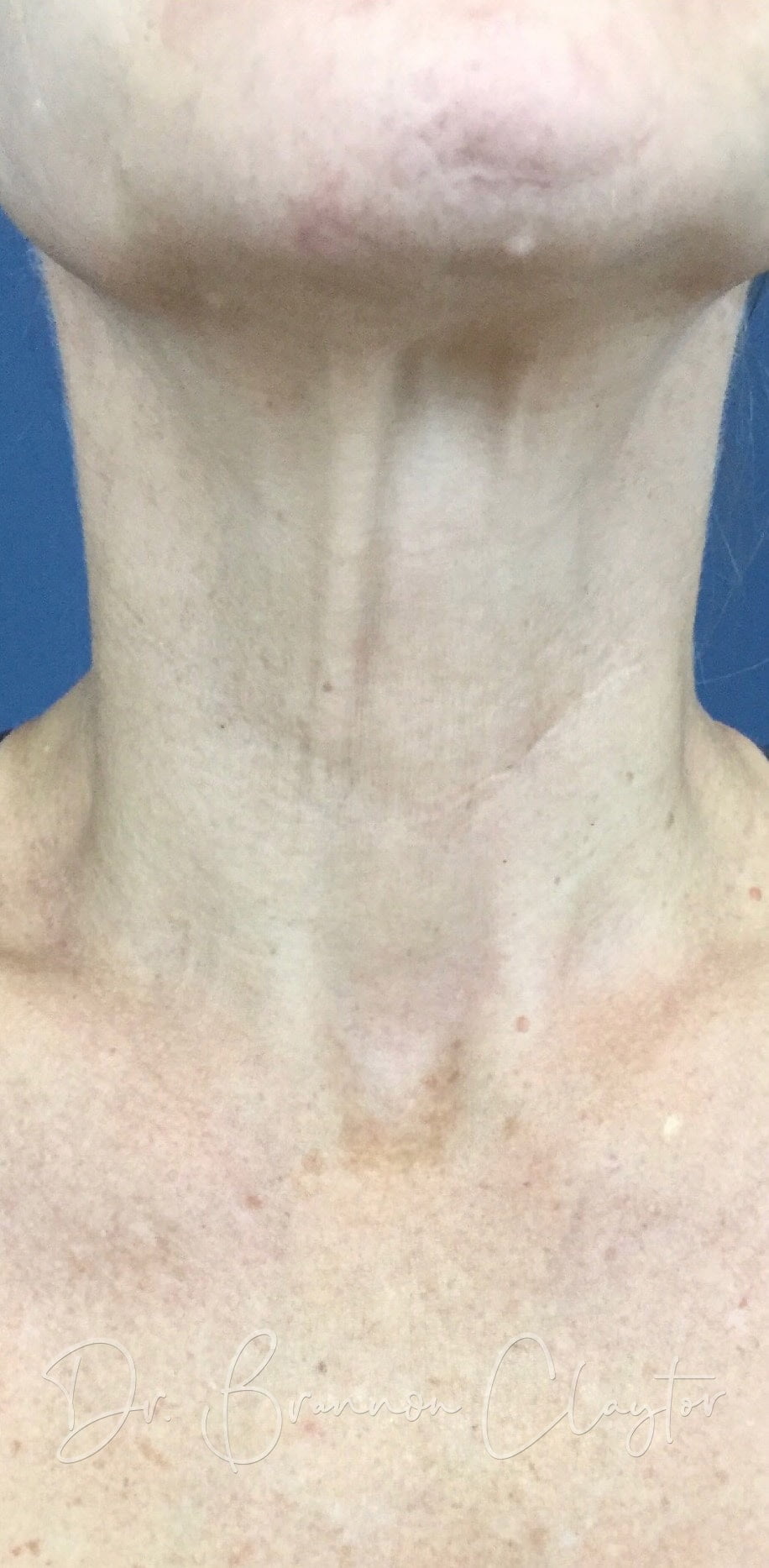 Dull Skin Tone - Philadelphia, PA - Claytor Noone